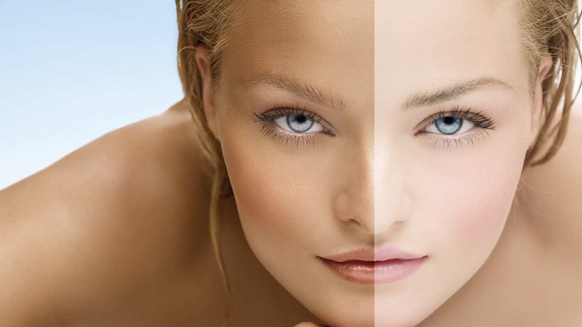 Best Pigmented Skin Treatment in Dubai - The Health Blog - Fidoc